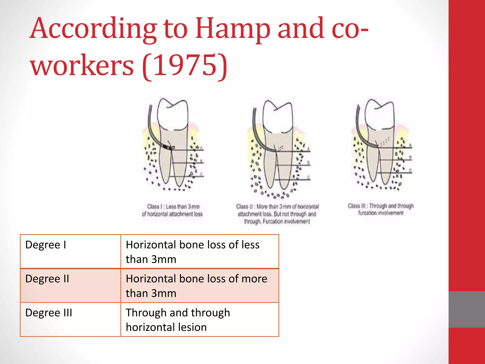 Furcation involvement | PPTX
