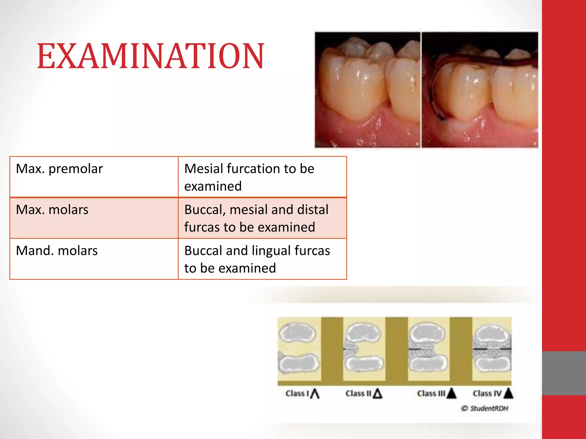 Furcation involvement | PPTX