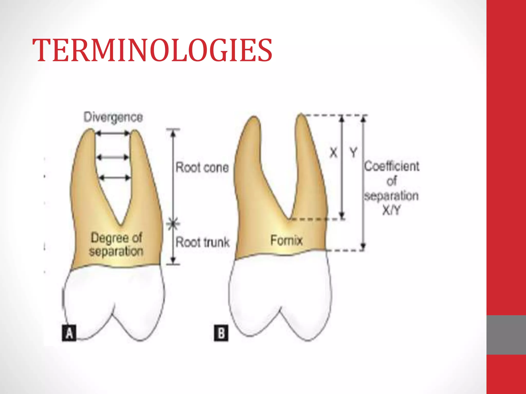 Furcation involvement | PPTX