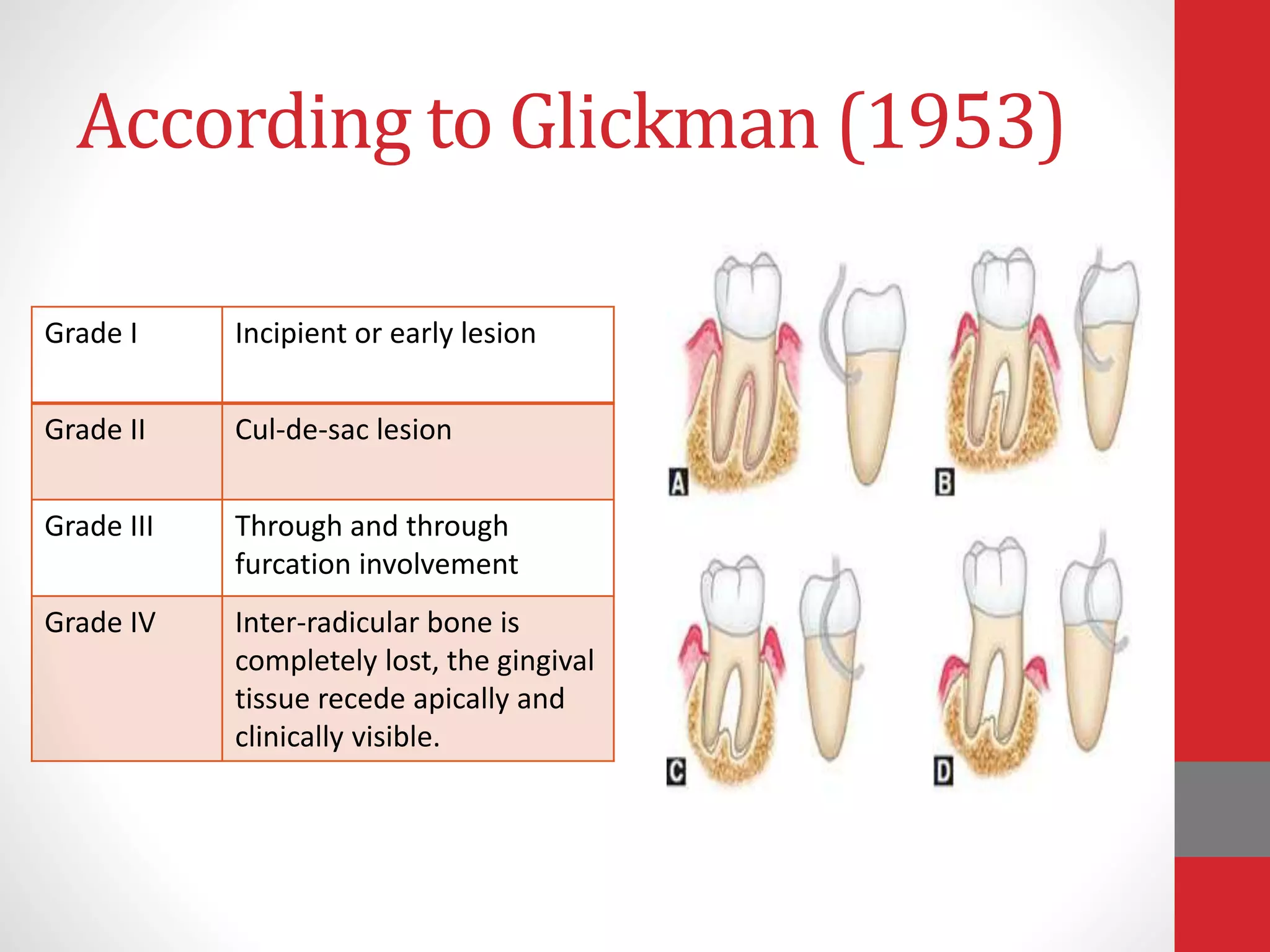 Furcation involvement | PPTX