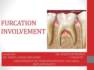 Furcation involvement | PPTX