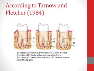 Furcation involvement | PPTX