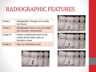 Furcation involvement | PPTX