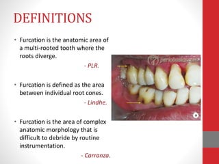 Furcation involvement | PPTX