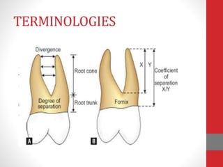 Furcation involvement | PPTX
