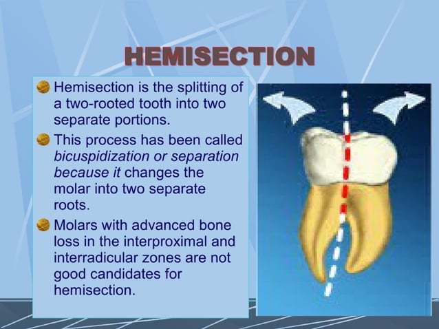 Furcation Involvement and its Therapy.pptx