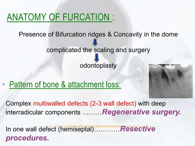 Furcation involvements and its treatments | PPTX