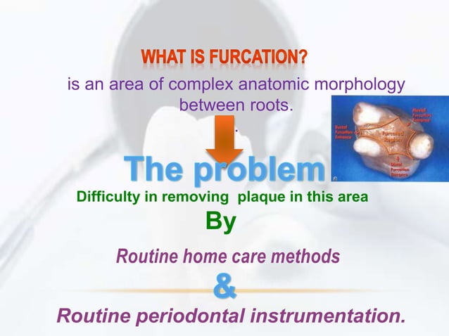 Furcation involvements and its treatments | PPTX
