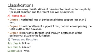 Furcation involvement in general dental practice | PPT