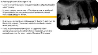 Furcation involvement in general dental practice | PPT