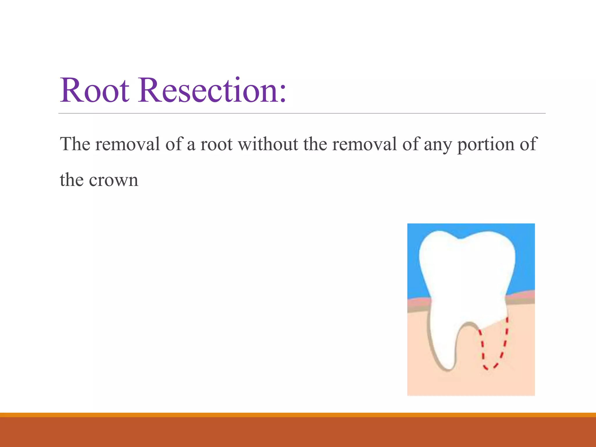 Furcation involvement | PPT
