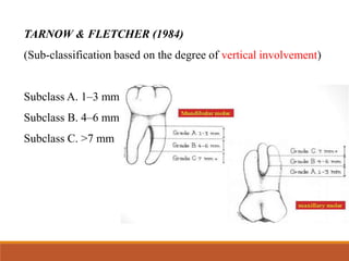 Furcation involvement | PPT