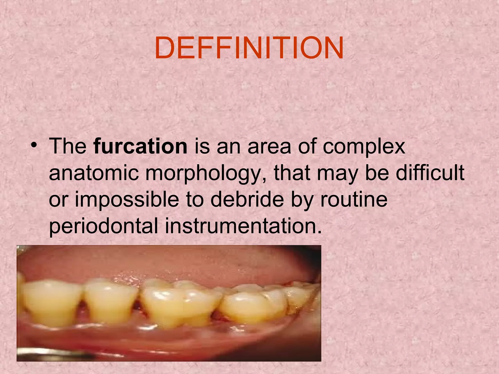 Furcation ppt | PPT