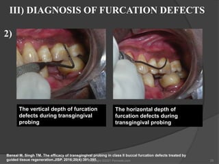 Furcation the problem and its management | PPTX