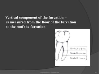 Furcation the problem and its management | PPTX
