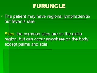 FURUNCLE.ppt