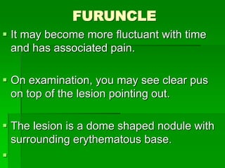 FURUNCLE.ppt