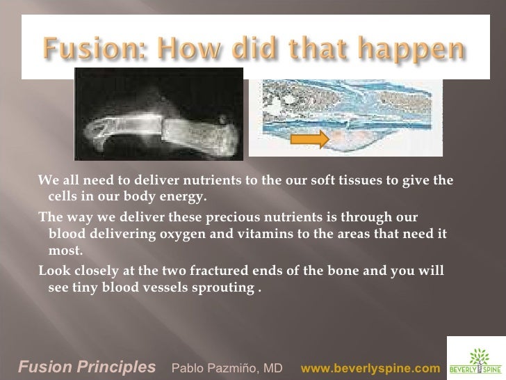 Fusion Principles by Pablo Pazmino MD