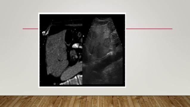 Fusion IMAGING.pptx | Medical Tests | Medical Health