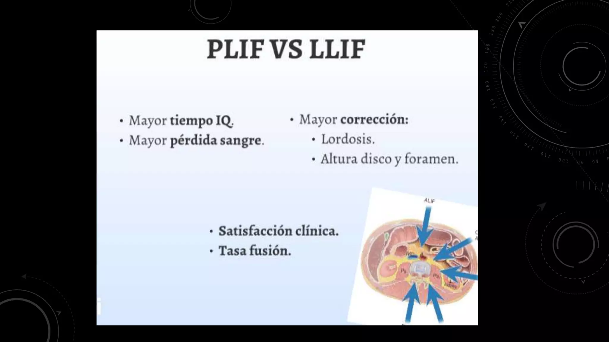 Fusion intersomatica lumbar.pptx