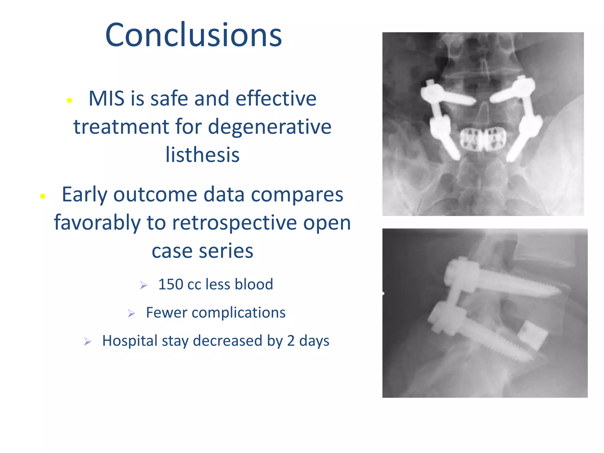 Fusion with open or minimally invasive techniques in degenerative ...