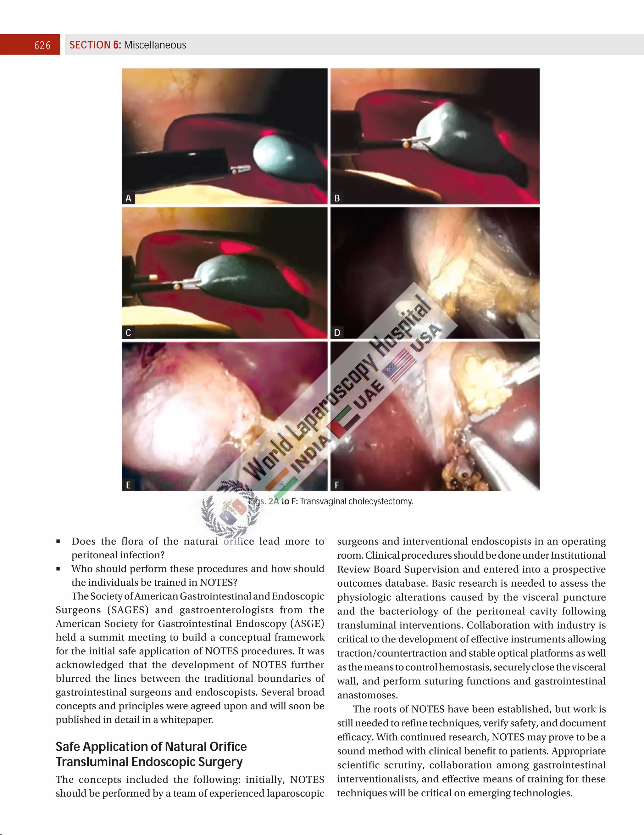 Future of Minimal Access Surgery | PDF