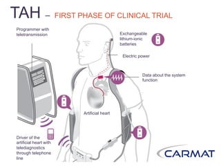 Future of cardiology | PDF
