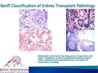 Solez Stem Cell and Future of Transplantation | PPTX
