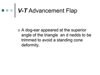 V-T advancement flap. | PPT