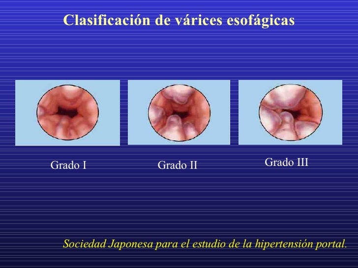 FW: clases gastro