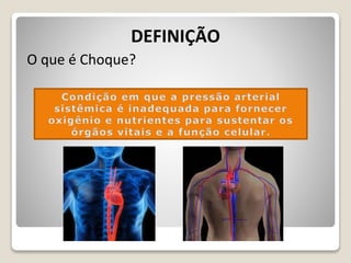 FWAE avaliação unidade 4 - Curso de Choque | PPTX