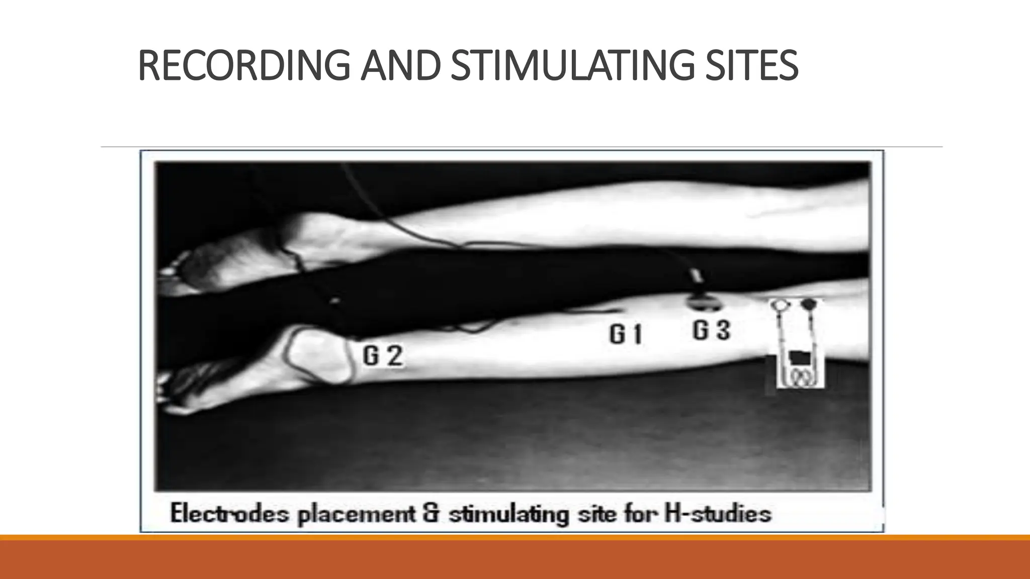 Presentation about late responses f wave h reflex.ppt