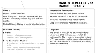 Presentation about late responses f wave h reflex.ppt