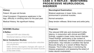 Presentation about late responses f wave h reflex.ppt