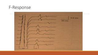 Presentation about late responses f wave h reflex.ppt