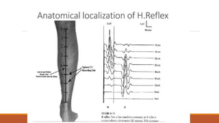 Presentation about late responses f wave h reflex.ppt
