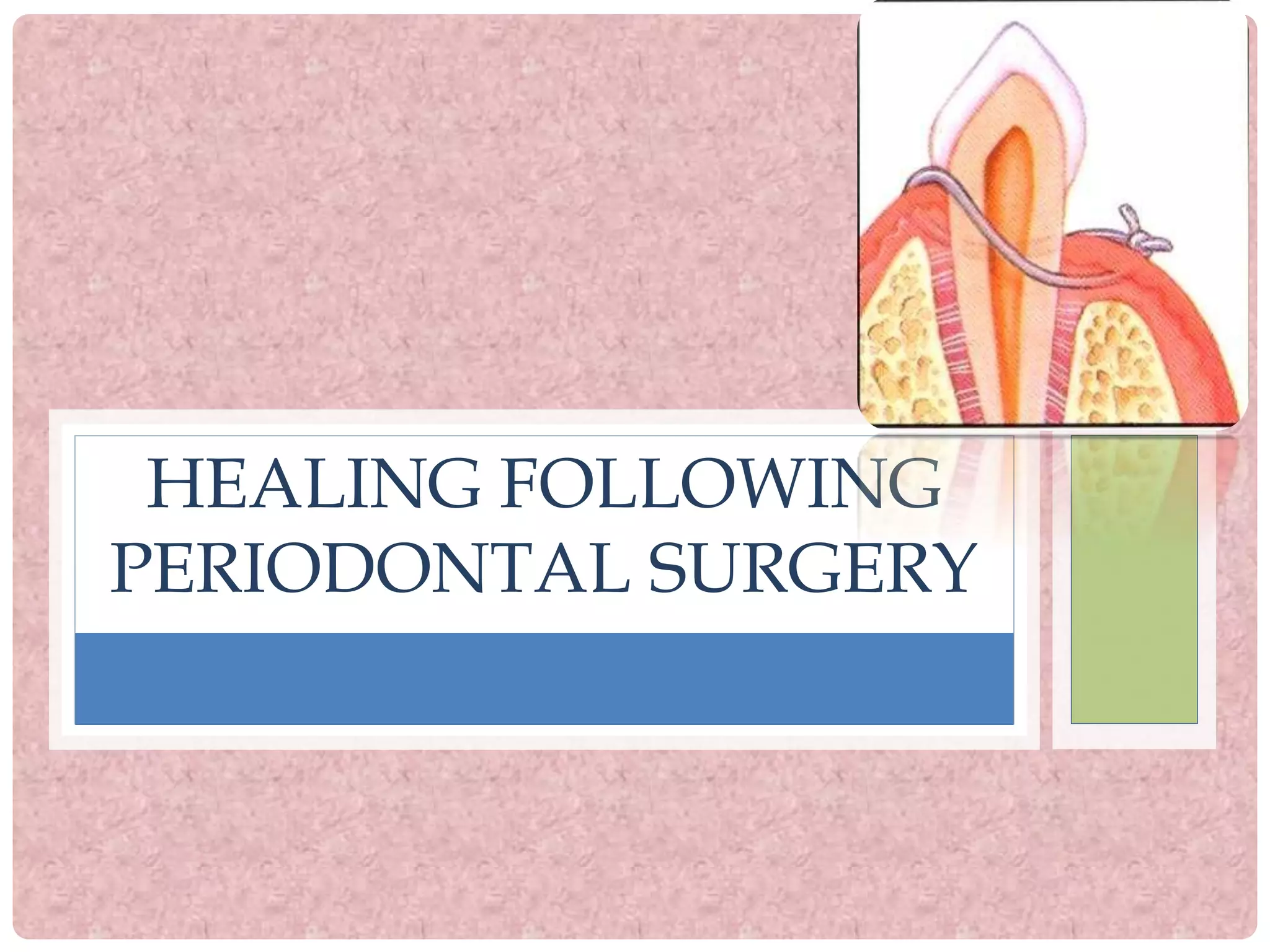 Healing following pdl surgeries.pptx