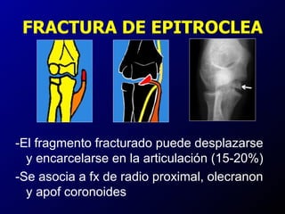 Fx apofisiarias codo clase diego fin | PPT