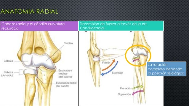 Fractura de cabeza de radio