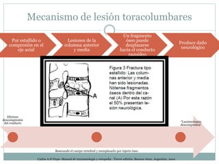 Fractura columna cervical y lumbar | PPTX