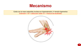 Fractura del carpo traumatologia aplicada | PPT