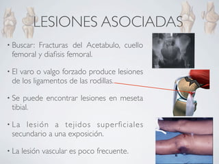 Fracturas de Femur Distal | KEY