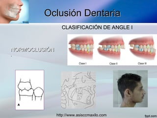 FX DE MANDIBULA anatomía, manejo y técnicas quirurvicas.ppt