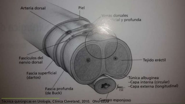 Fractura de pene