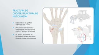 FX de radio distal .pptx
