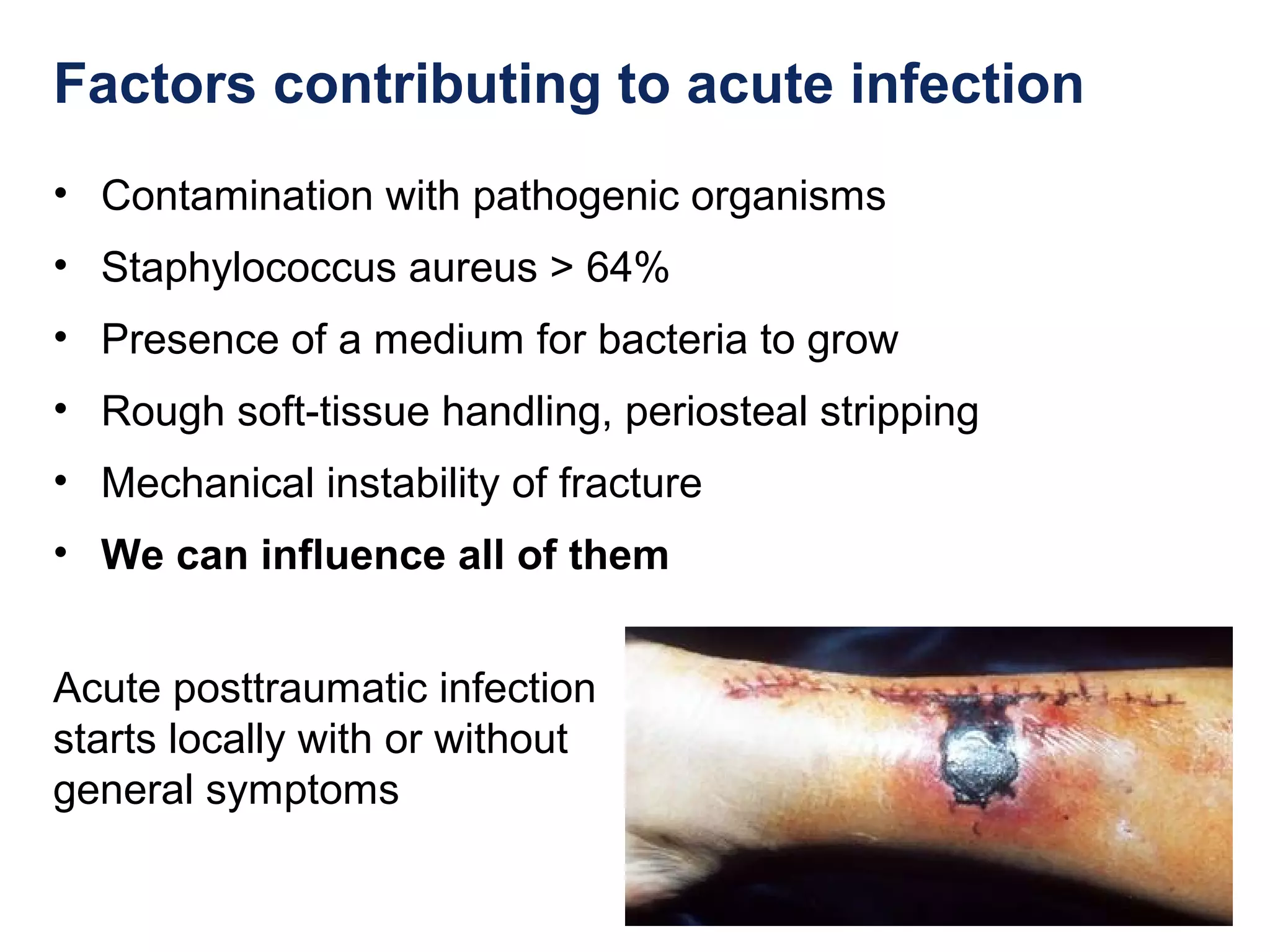 Infection | PPT