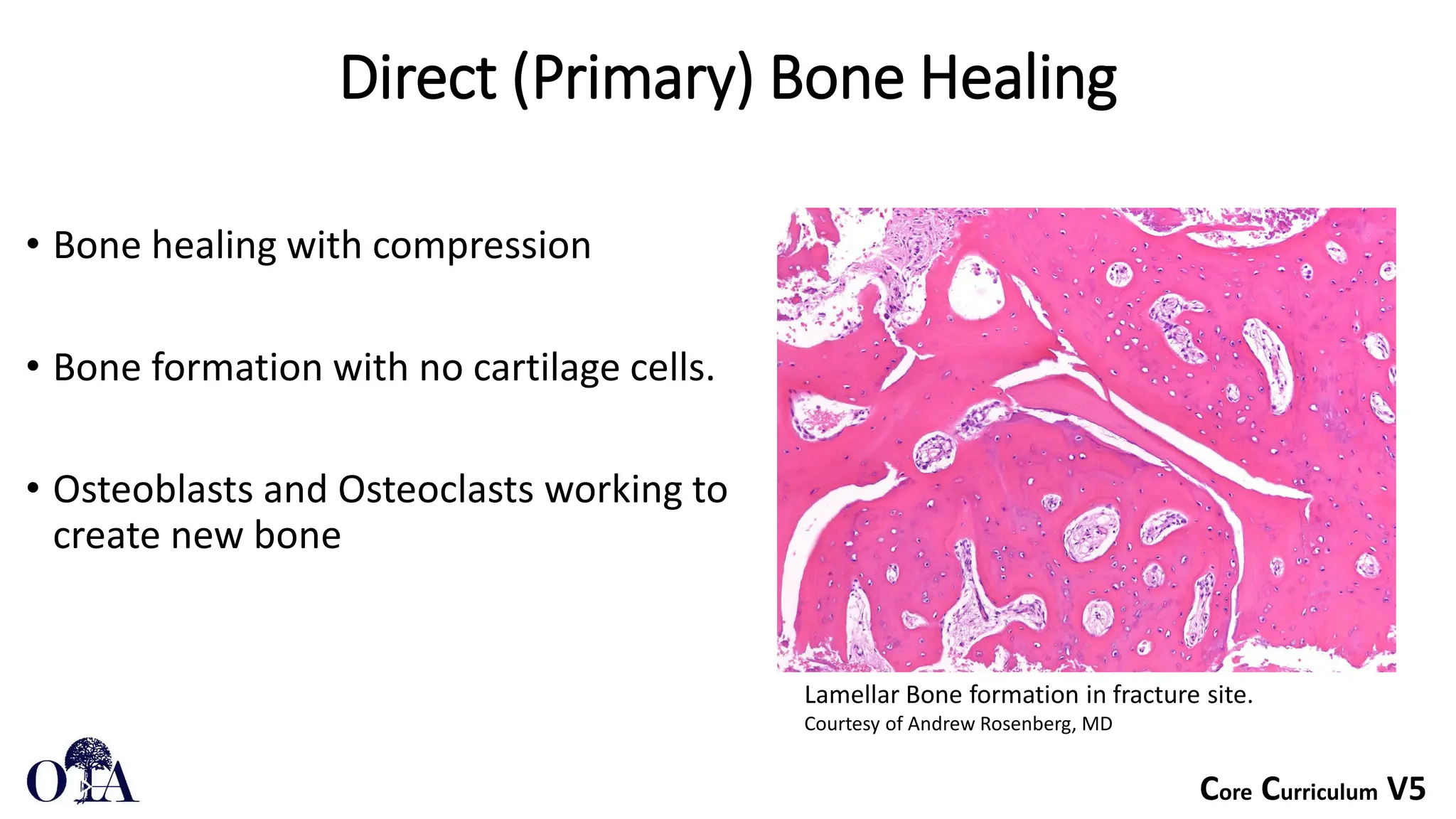 Fx Healing 1 Biology of Bone repair.pdf