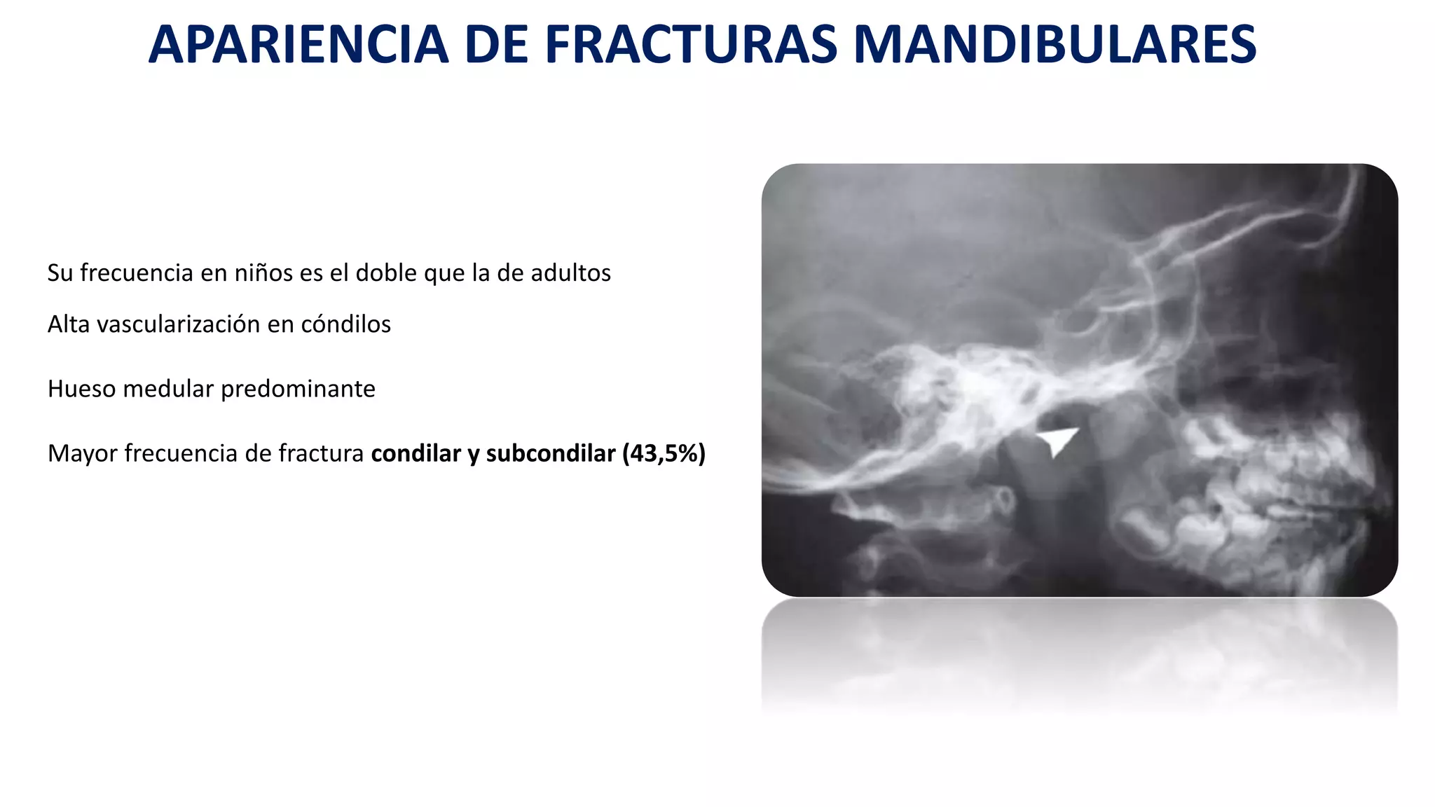 fracturas de mandibula en niños .pptx | Descarga Gratuita