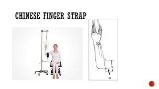 colles' fracture case dicussion | PPTX