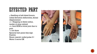 colles' fracture case dicussion | PPTX
